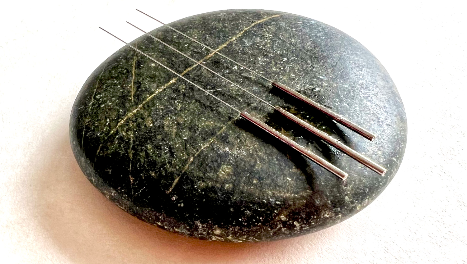 Prenatal Acupuncture Follow-up | Book Online