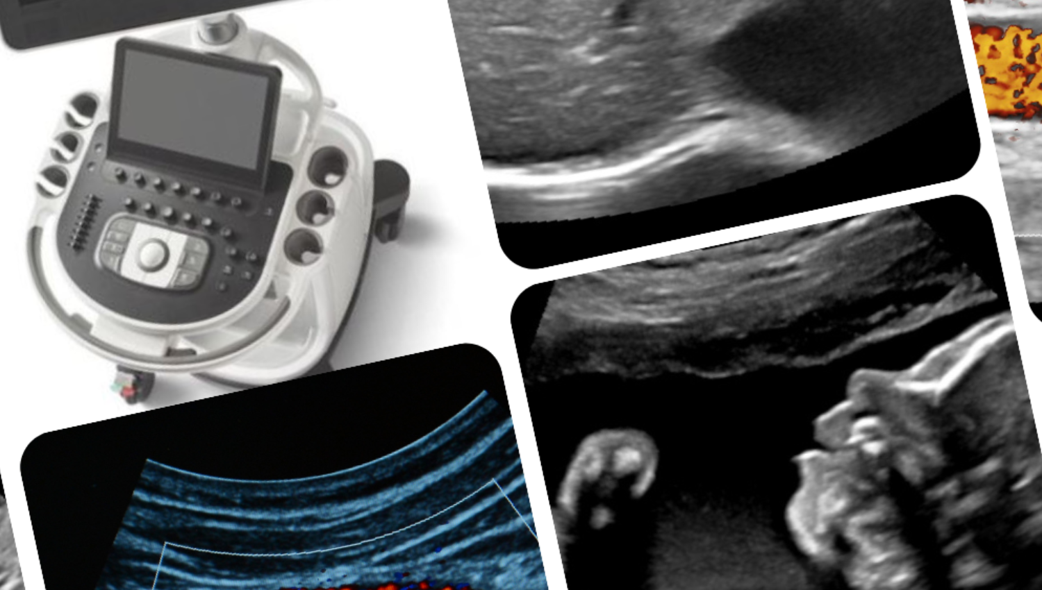 Pelvic: Transvaginal Only, CPT 76830 | EloRose Diagnostic Ultrasound